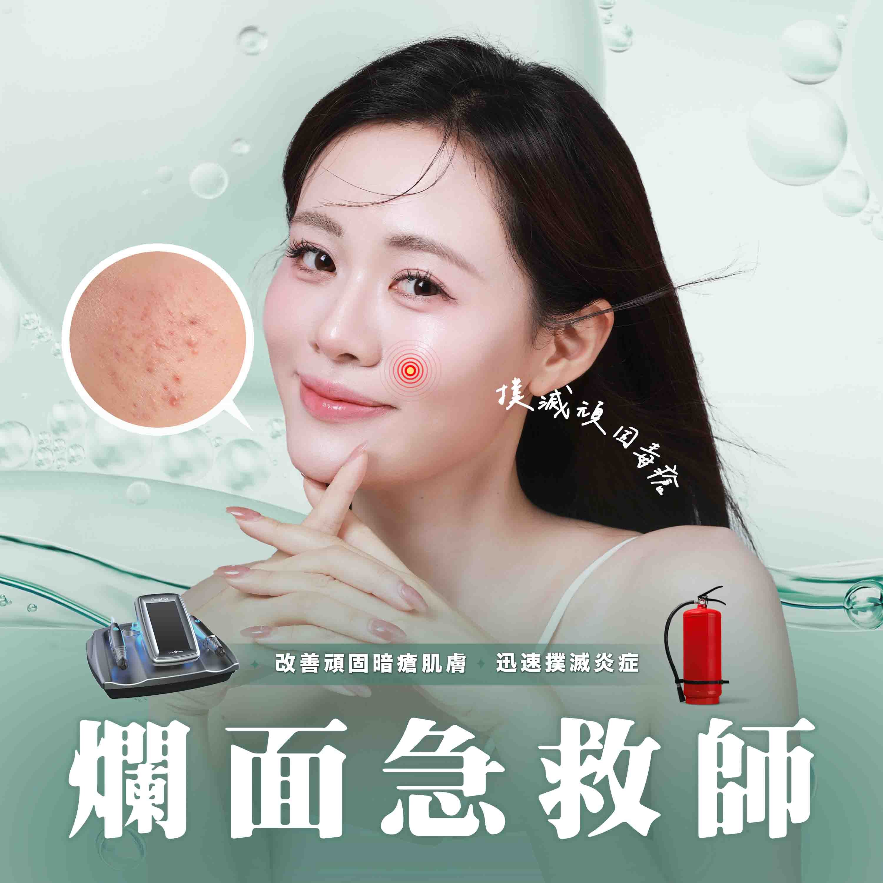 Super Acne 爛面急救師 – Holy Daily